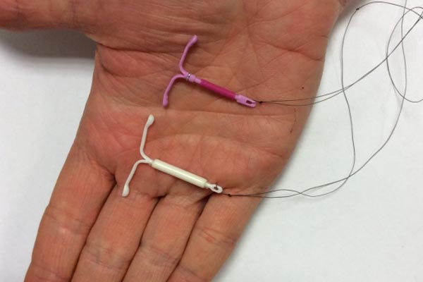 A case for IUDs - Daily Monitor
