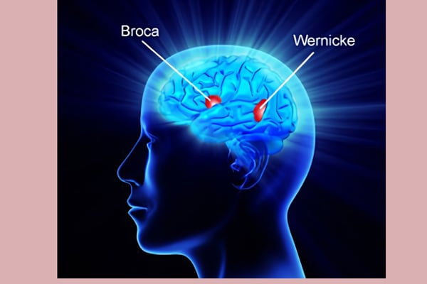 Understanding aphasia, a brain disorder | Monitor